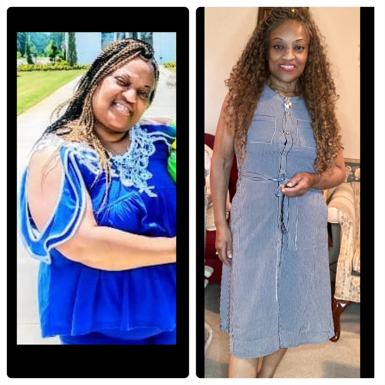 BMI Priority Pass | Weight Loss Surgery | Gastric Sleeve Surgery
