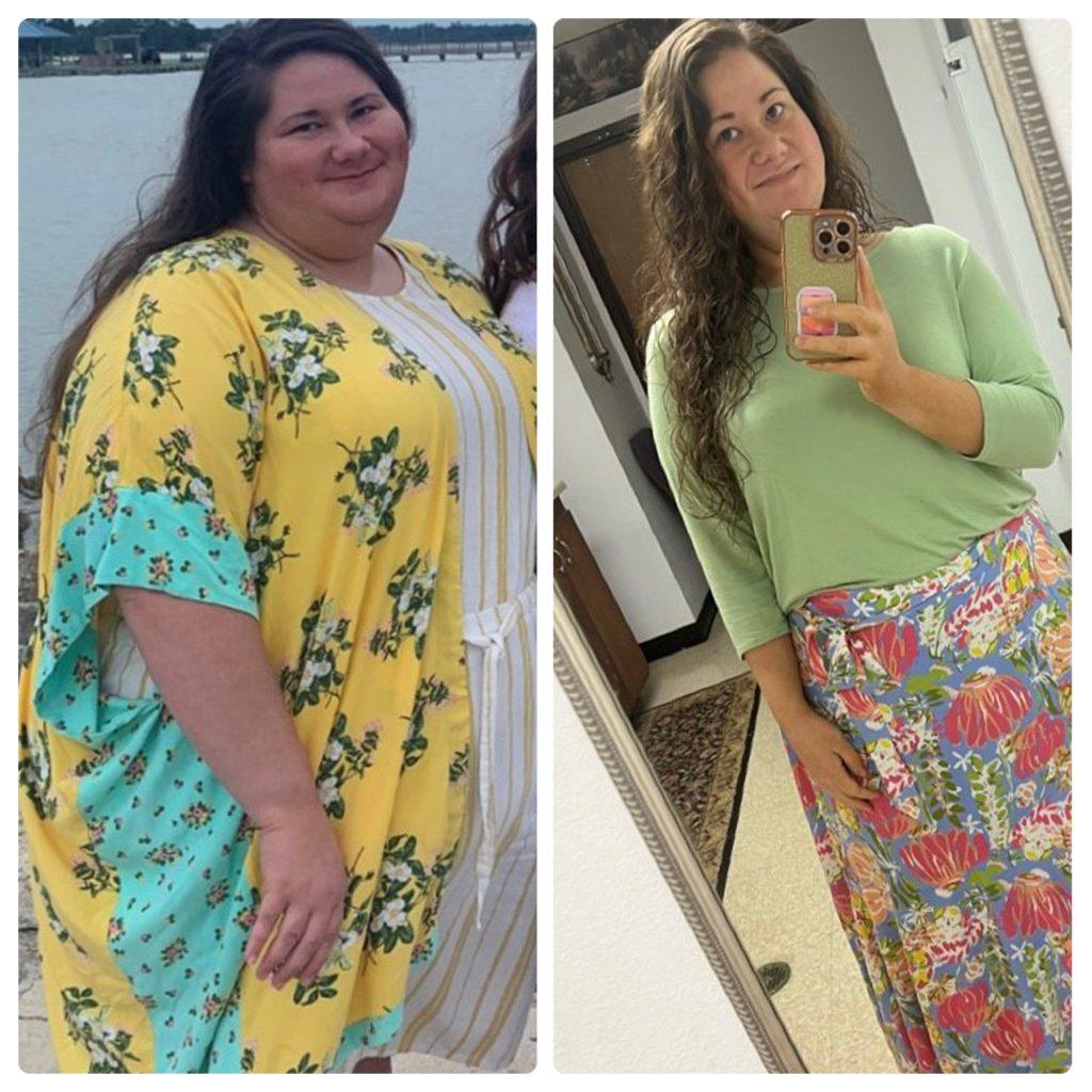 BMI Priority Pass | Weight Loss Surgery | Gastric Sleeve Surgery